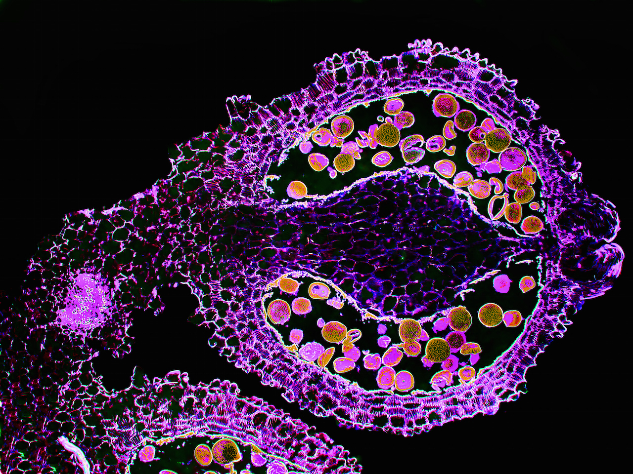 Psychedelic Micrographs Illuminate the Structures of Cells