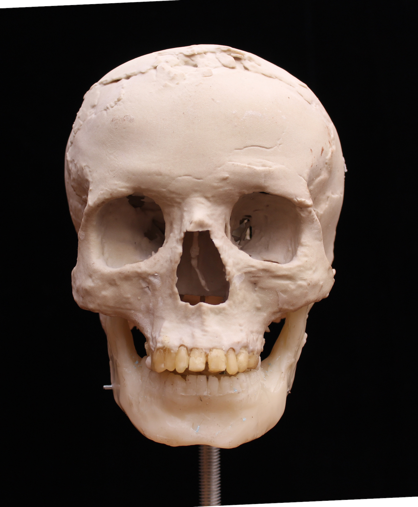 Recreating the Face of a 9,500-Year-Old Man