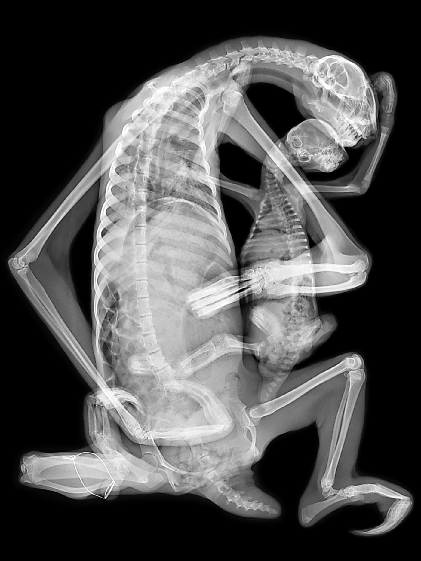 Considering the Clarity of X-ray Photography