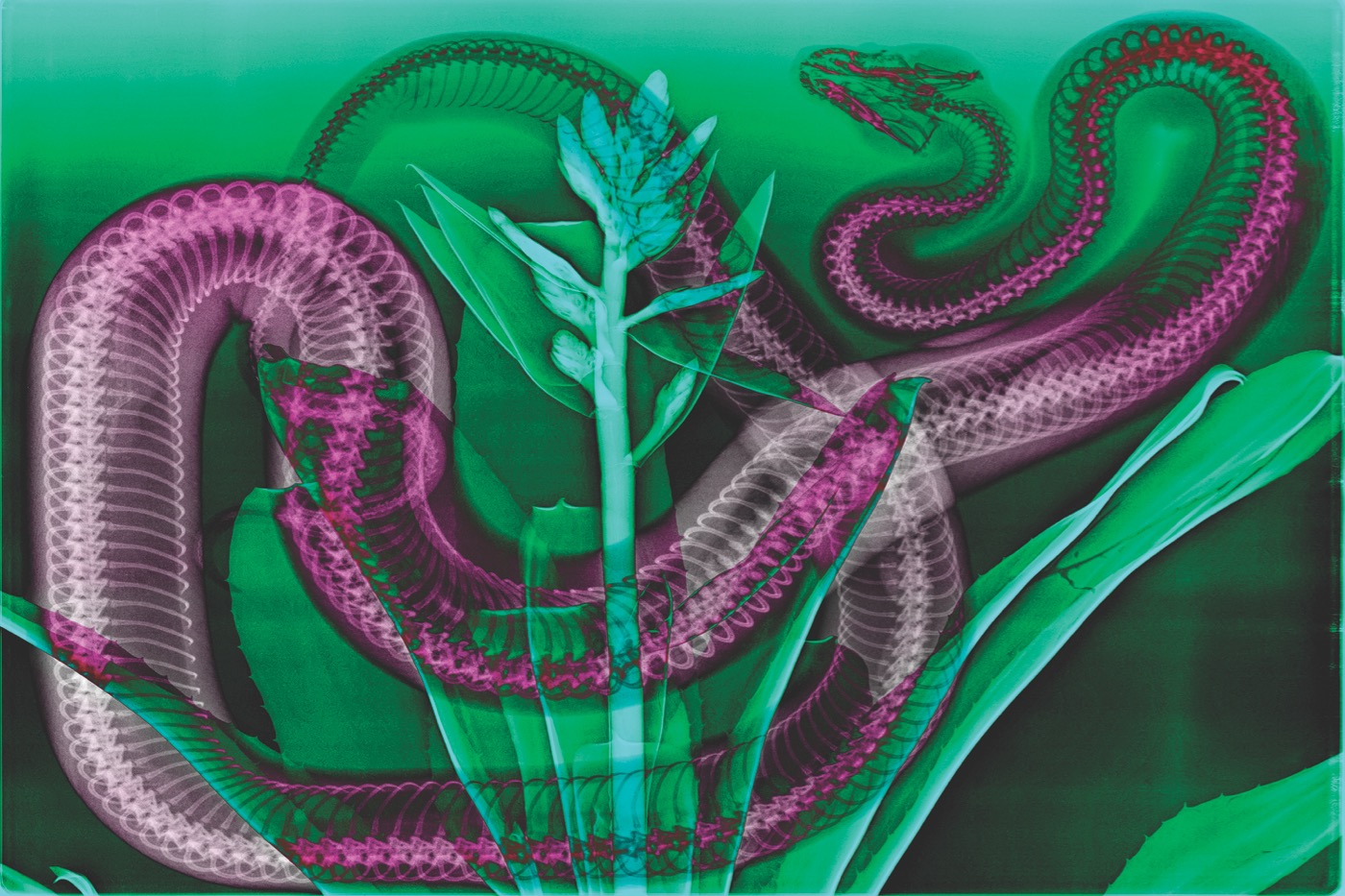 Considering the Clarity of X-ray Photography