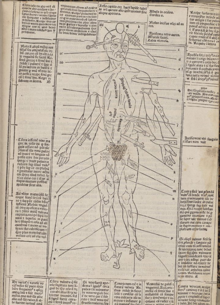 One of the Earliest Illustrated Medical Books Offers a Lens Into ...